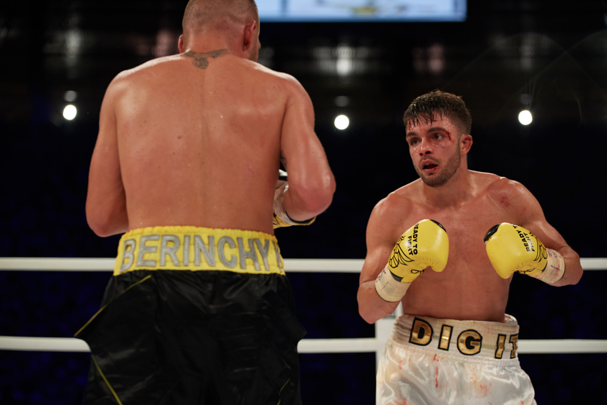 Anthony Yigit Describes Treatment After Fight - Big Fight Weekend