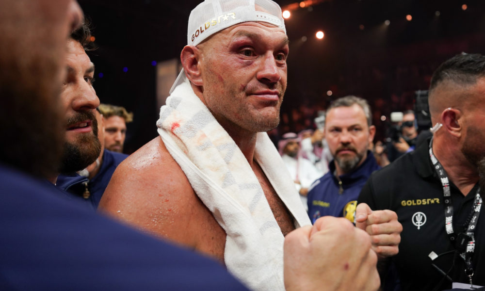 Tyson Fury Retirement Sparks Speculation About 2025 Return