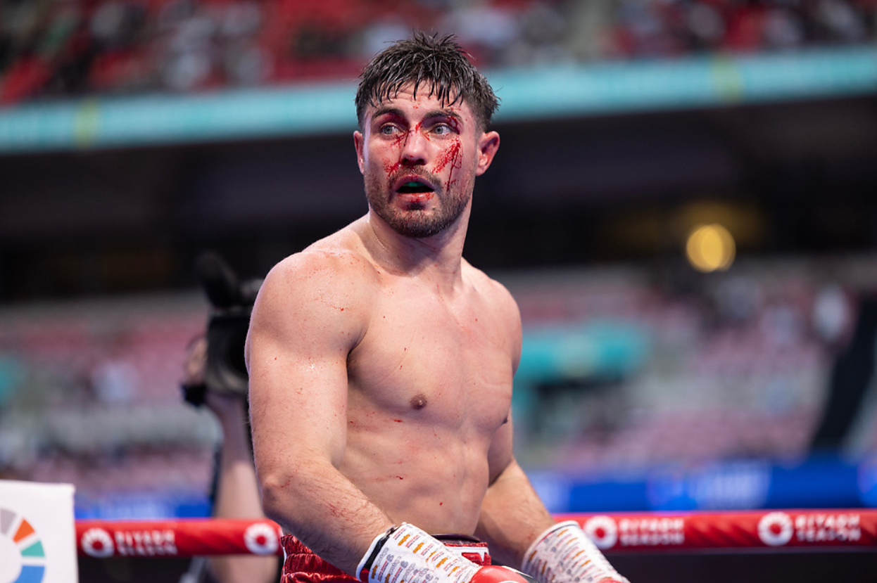 Frank Smith clarifies Josh Kelly Matchroom Boxing situation